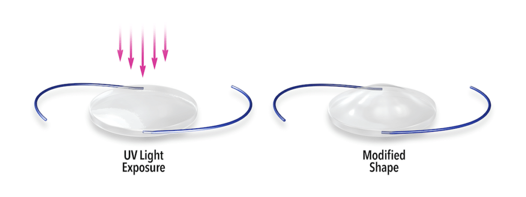 Light Adjustable Lens | Barnet Dulaney Perkins Eye Center